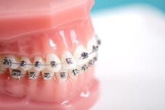 Turquoise Braces Stock Photos - Royalty Free Images
