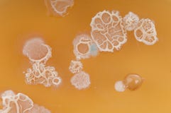 Colônias Bacterianas Das Mãos Sujas. Imagem de Stock - Imagem de ...