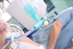 Patient In Critical Condition In The ICU Stock Photo - Image of ...