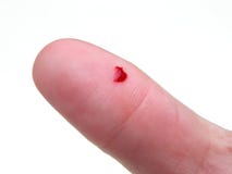 Awe! My Wound Hurts - A Prescription for Healthy Living