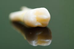 Extracted Tooth With Strange, Curved Root Stock Photo - Image: 18187650