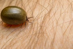 Tick on skin with hair stock photo. Image of parasite - 35435930