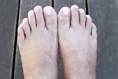 Foot and bacteria stock illustration. Illustration of germ - 16090470