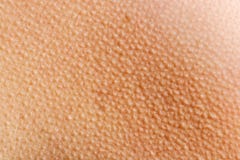 3+ Goosebumps Free Stock Photos - StockFreeImages