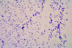 AFB Positive Stock Photo - Image: 49323506