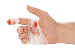 Injured Hand Cut Blood Stock Photos - 246 Images