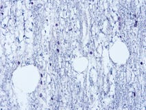 Histology Of Human Muscle Tendon Connection Tissue Stock Photo - Image ...