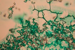 Human Cells And Water At The Microscope Stock Photo - Image of nucleus ...