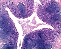 Histology of the appendix stock photo. Image of normal - 44133822