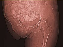 Amputation Stock Photos - Royalty Free Stock Images