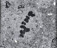 Cell nucleus. TEM stock photo. Image of karyoteca, micrograph - 117239954