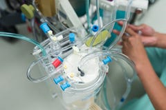 Cardiopulmonary Bypass Machine During Heart Surgery Stock Photo - Image ...