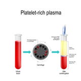Plasma Sanguin Et éléments Formés Dans Le Tube à Essai Illustration de ...