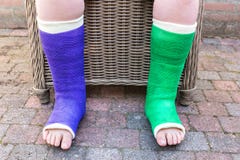 Ein Gipsbein Junge Auf Gras Stockfoto - Bild von obacht, kind: 78539556