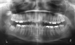 Closeup of bad teeth stock image. Image of care, discolor - 18111309