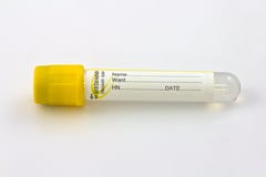 Yellow test tube. stock image. Image of education, chemical - 7390417