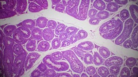 Microscopic Section Of Testis T. S Stock Photo - Image of life ...