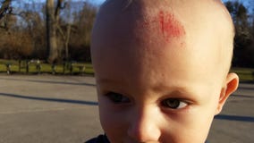 Head Injury Stock Photos - Royalty Free Pictures