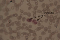 Monocyte Stock Photos - Royalty Free Images - Dreamstime