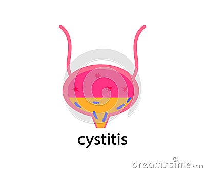 Bladder On A White Background. Cystitis. Vector | CartoonDealer.com ...