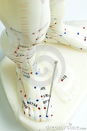 Acupuncture Demonstration On Model Royalty-Free Stock Photo ...