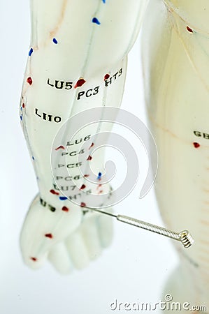 Acupuncture Demonstration On Model Royalty-Free Stock Photo ...