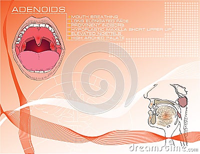 Adenoids Background Vector Illustration | CartoonDealer.com #21702534