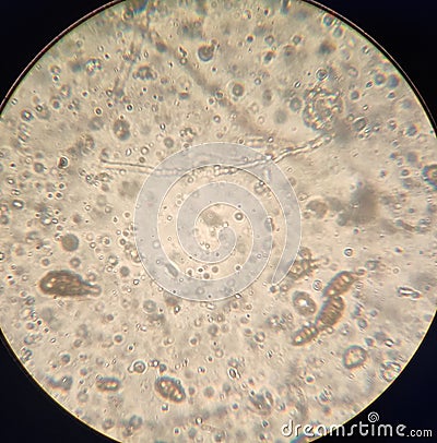 Alternaria Fungus Spores Under The Microscope Stock Photography ...