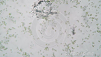 The Amoeba Moves Fast in a Drop of Water Time Lapse Stock Video - Video ...