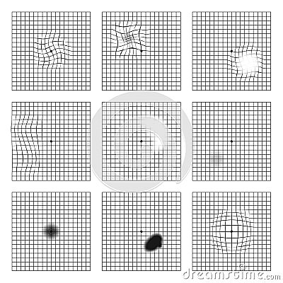 Amsler Eye Test Grid. Oculist Vector Printable Chart Retina Examination ...