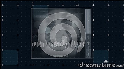 Animation of Black Digital Screen with X Ray Photo and Graphs Stock ...