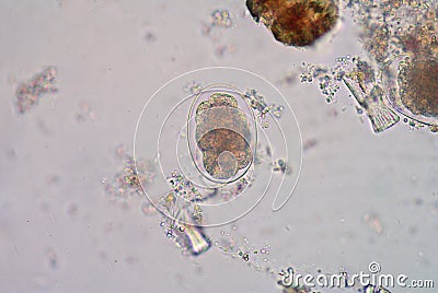 Ankylostome Photo stock - Image: 51698807