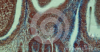 Appendix transverse stock footage. Video of secretion - 204499646