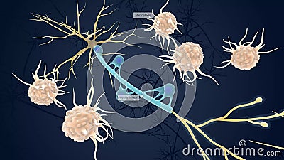 Autoimmune Attack on Myelin Sheath Stock Video - Video of cell, axon ...