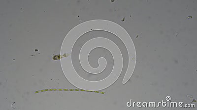 Baby of Triops Under a Microscope. Stock Video - Video of genus ...