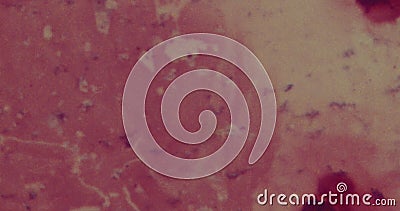 Bacteria Under a Microscope in a Hospital Stock Video - Video of ...