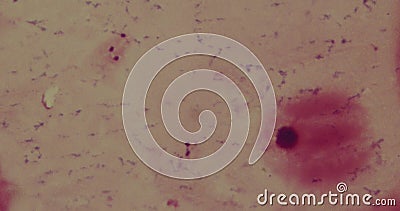 Bacteria Under a Microscope in a Hospital Stock Footage - Video of ...