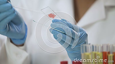 Bacteriologist Analyzing Microbiological Specimens, Blood Sample, HIV ...