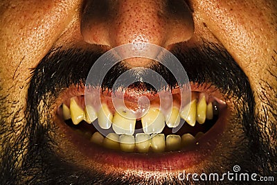Bad Teeth - Stock Image - Everypixel