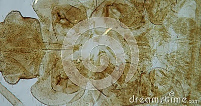 Bed bug stock footage. Video of secretion, nervus, parasite - 205025662