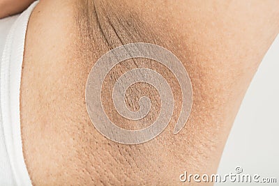 Black Armpit Skin Stock Photography | CartoonDealer.com #125715290