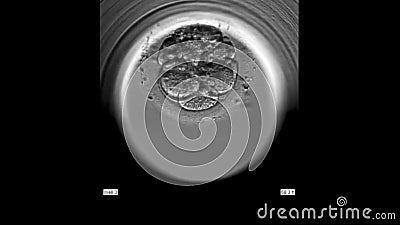 Blastocyst Formation Human Egg Fertility Cell Division Time Lapse Under ...