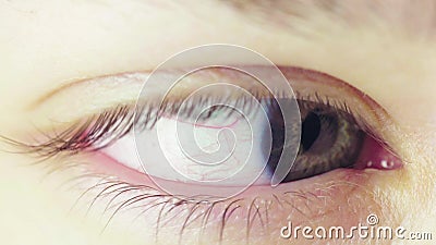 Blinking Human Eye. Constriction of the Iris in Bright Light Stock ...