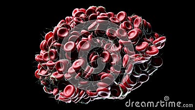 A blood clot stock video. Video of cardiovascular, hemoglobin - 140234399