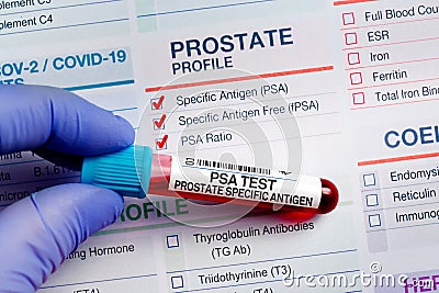 Blood Tube Test With Requisition Form For PSA Prostate Specific Antigen ...