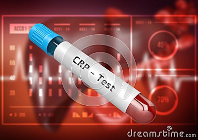 Blood Sample Tube For C-reactive Protein CRP Test Royalty-Free Stock ...