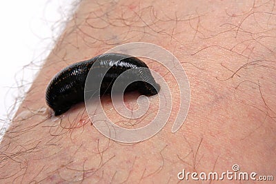 Blood Sucking Leech On Man Leg Stock Photos - Image: 11409283