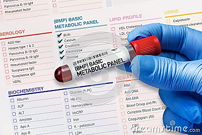 Blood Tube Test With Requisition Form For BMP Basic Metabolic Panel ...