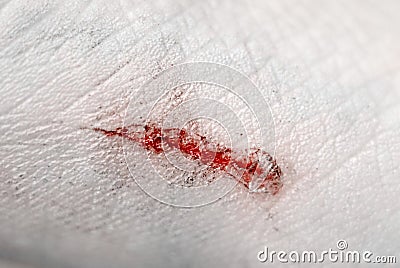 Bloody Scratch Closeup Stock Images - Image: 5672304
