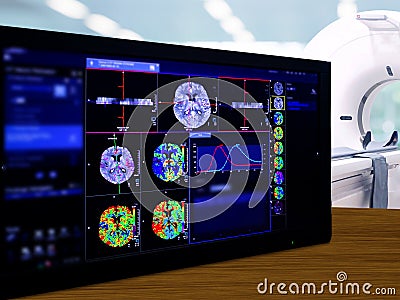 Brain Perfusion Or CT Scan Of Blood Flow. In The Brain 3d Rendering ...